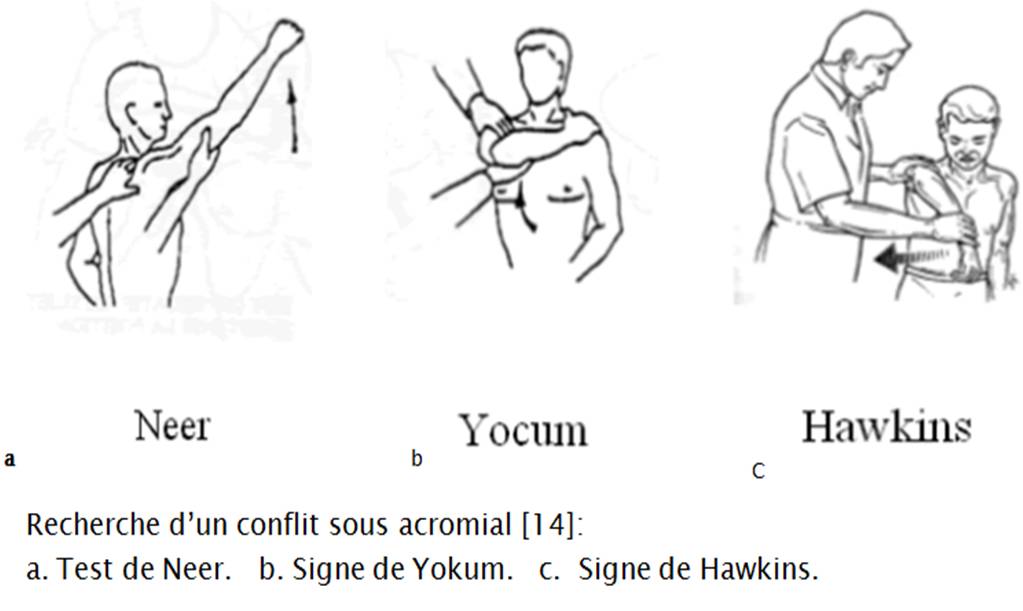 Autoformation d’échographie de l’épaule